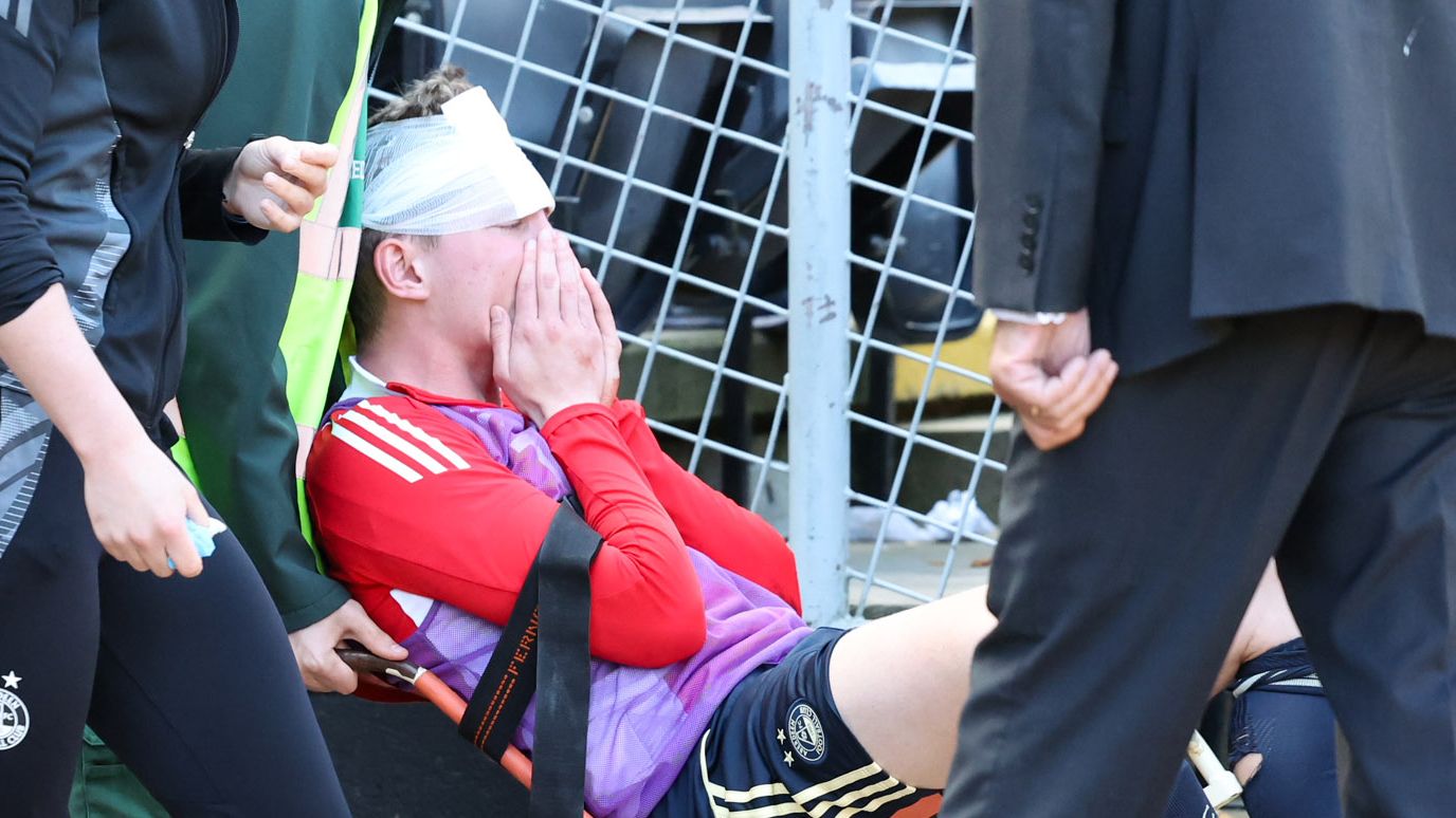 Supporter moet 18 maanden cel in vanwege ernstig verminken van eigen ...